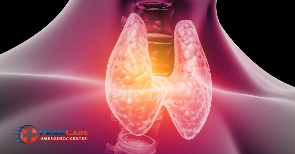 What is a Thyroid Storm? | PrimeCare Emergency Center